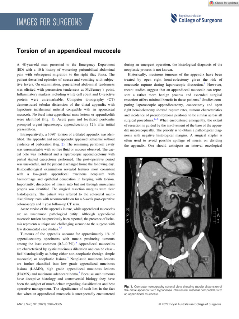 Anz Journal Of Surgery 2022 Primrose Torsion Of An Appendiceal