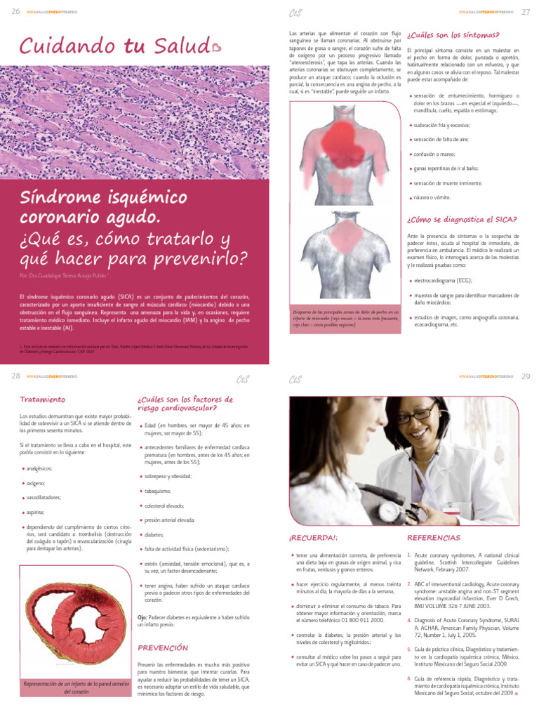 cts1 | PDF | Infarto de miocardio | Especialidades Medicas