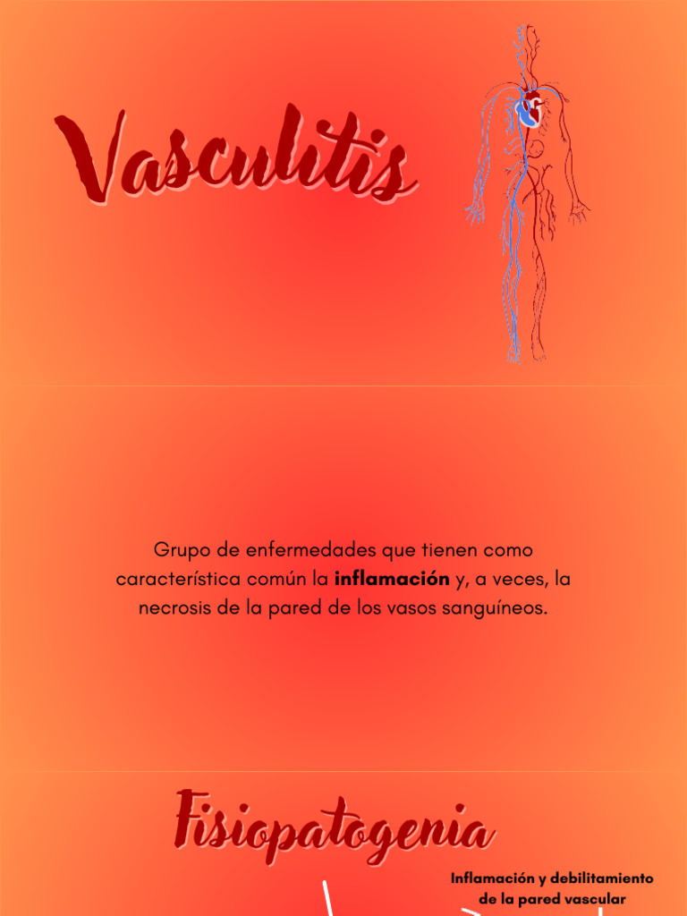 Guía Completa sobre Vasculitis | PDF | Isquemia | Inflamación