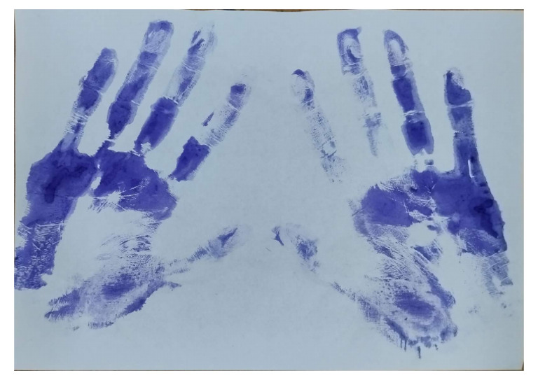 Hand Impression-Compressed | PDF