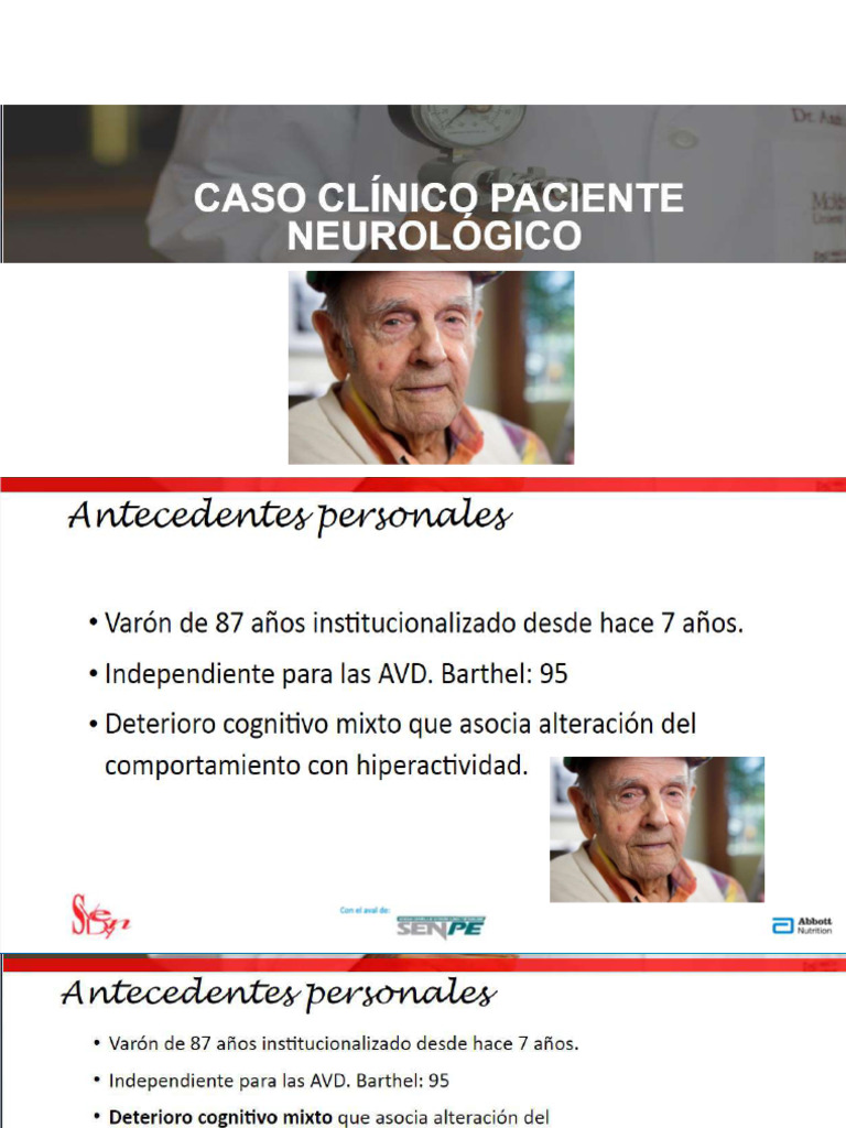 Caso Clinico 1 Ug Con Criterios Glim (4) - Compressed | PDF