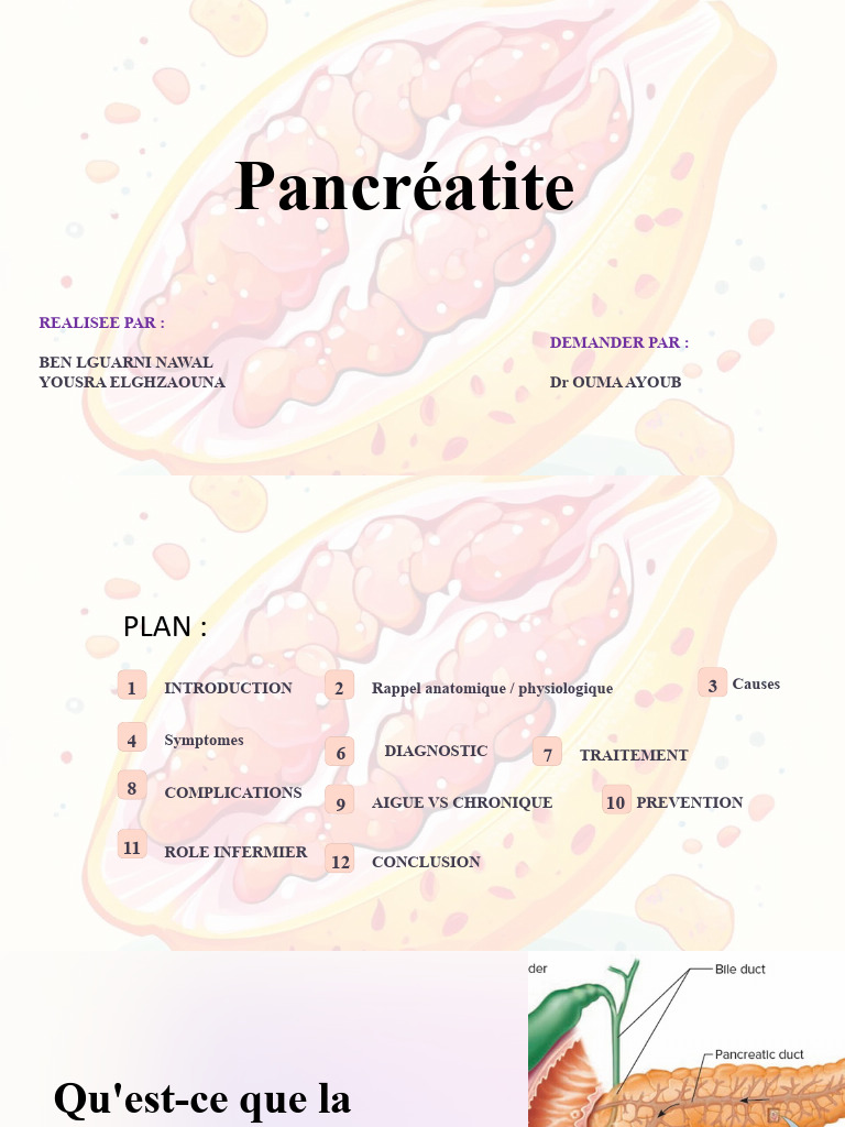 Comprendre la Pancréatite : Symptômes et Traitement | PDF | Pancréas ...
