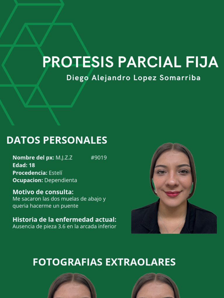 endo defensa | PDF | Boca | Diente