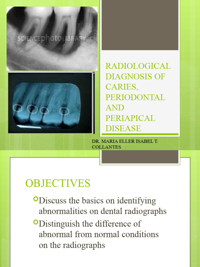 RADIOLOGICAL DIAGNOSIS OF CARIES PERIODONTAL AND PERIAPICAL Final 2 ...