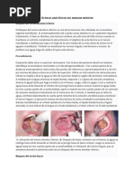 Técnica Gow Gates de Anestesia Mandibular | PDF | Anatomía humana ...
