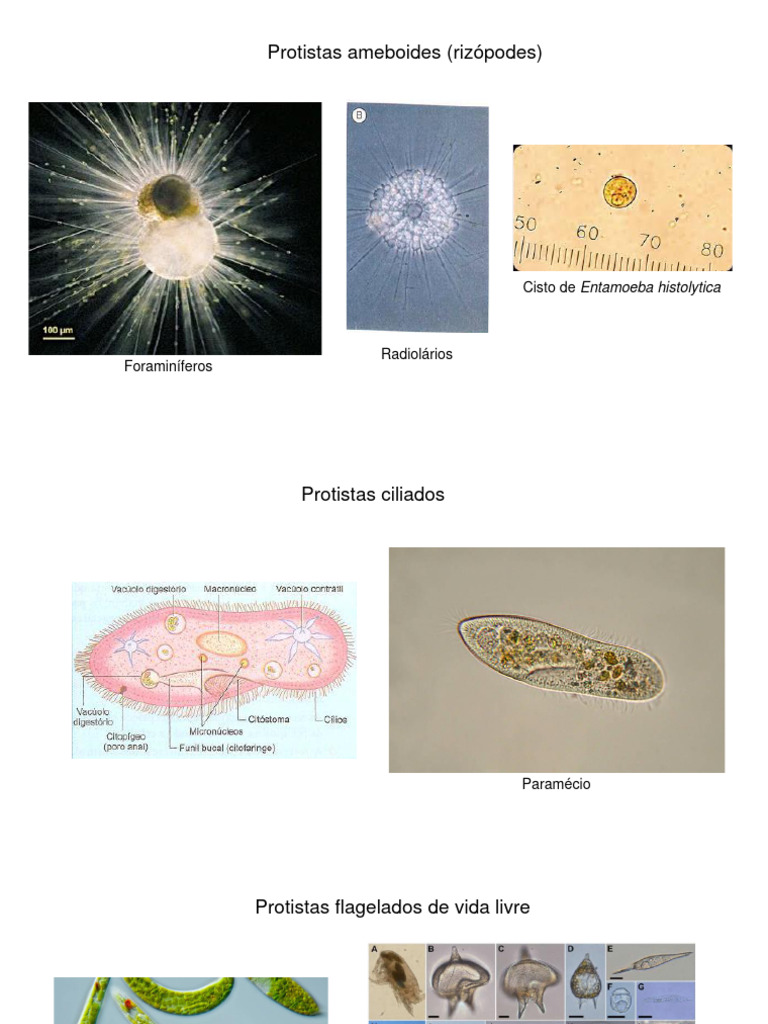 Tipos de Protistas e Seus Exemplos | PDF | Bactérias | Protozoários