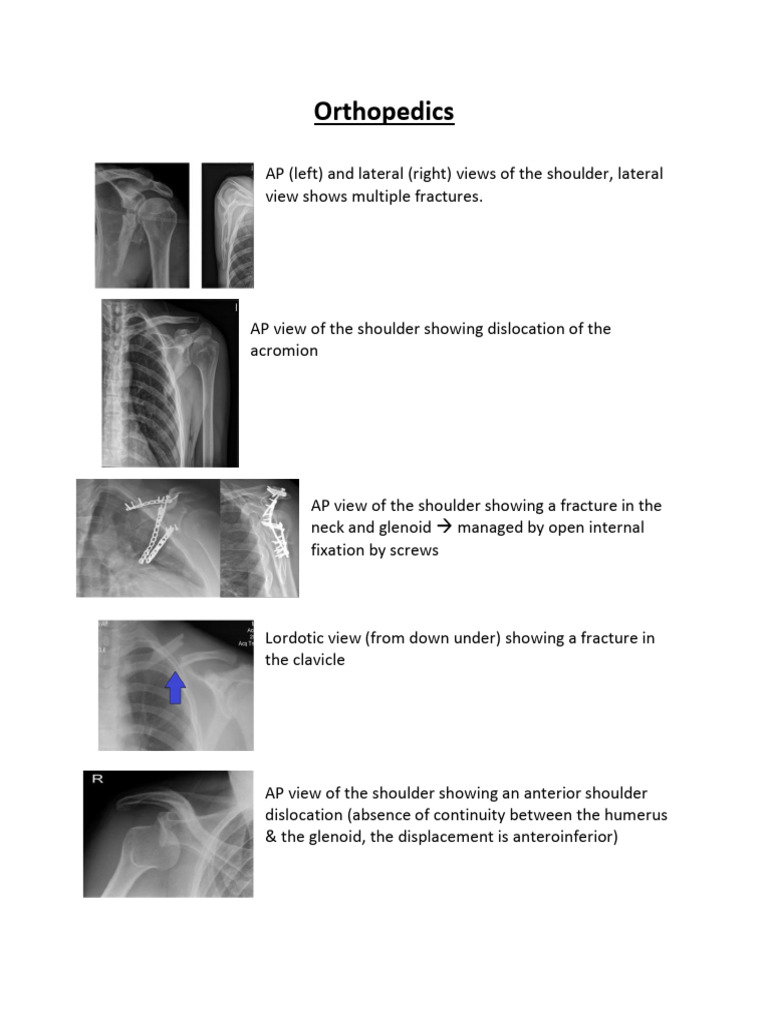 3 - Orthopedics OSCE | PDF | Elbow | Shoulder