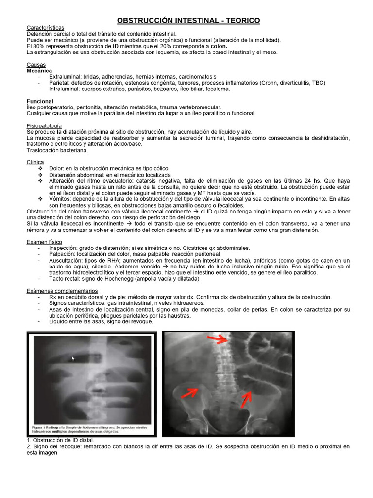 Obstrucción Intestinal Pdf Intestino Grueso Bilis