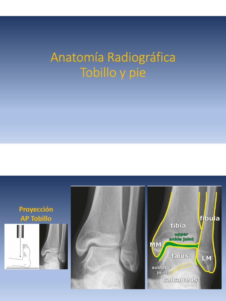 Anatomía Radiográfica Del Pie | PDF