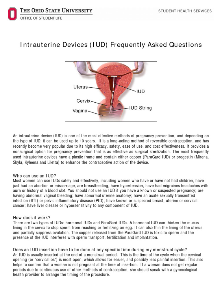 Intrauterine Devices Faq 02 19 | PDF | Birth Control | Clinical Medicine