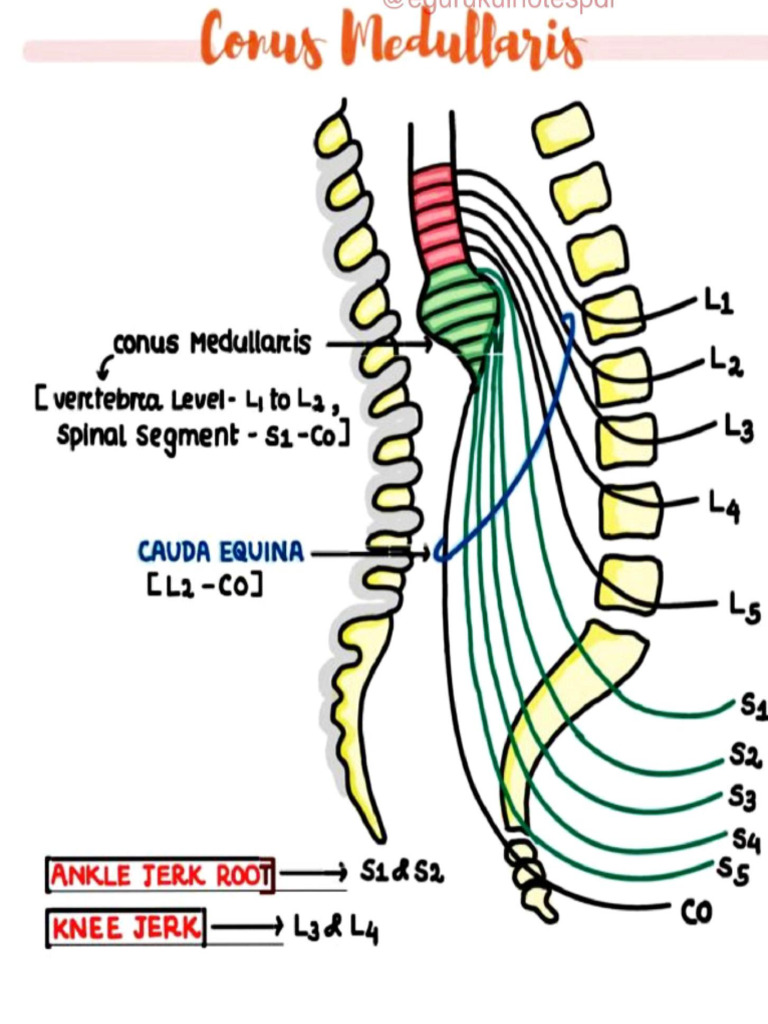 Conus Medullaris and Cauda Equina Syndrome | PDF | Feces | Medical ...