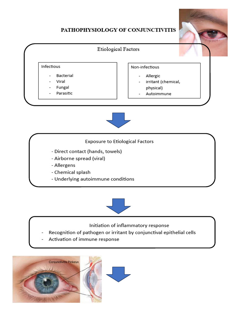 Pathophysiology of Conjunctivitis | PDF | Wellness | Science & Mathematics