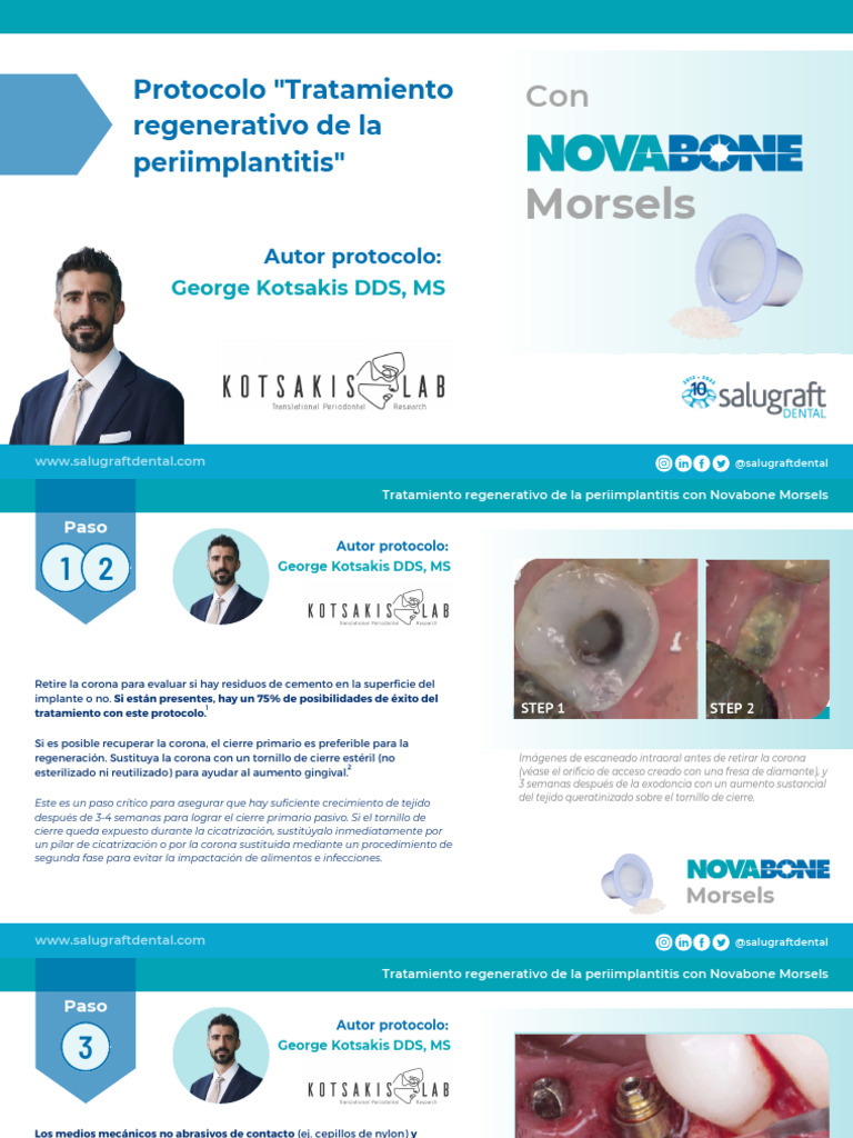 Protocolo Periimplantitis Novabone Morsels | PDF | Especialidades Medicas