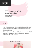 STEMI 12 Lead ECG Analysis Guide | PDF | Electrocardiography | Visual ...
