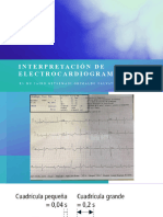Tabla_ Valores normales de ondas e intervalos del ECG | PDF | Corazón ...