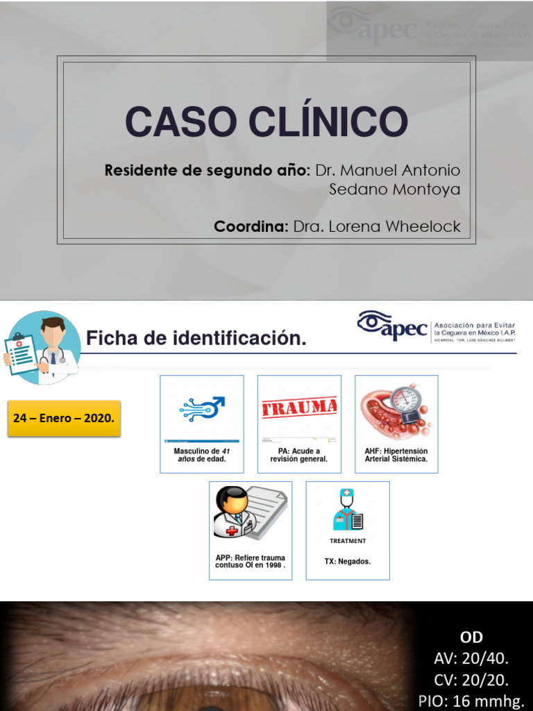 Many - Sosp Glauc | PDF | Glaucoma | Oftalmología