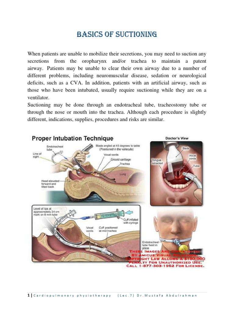 Basics of Suctioning: Cardiopulmonary Physiotherapy (Lec.7) DR ...
