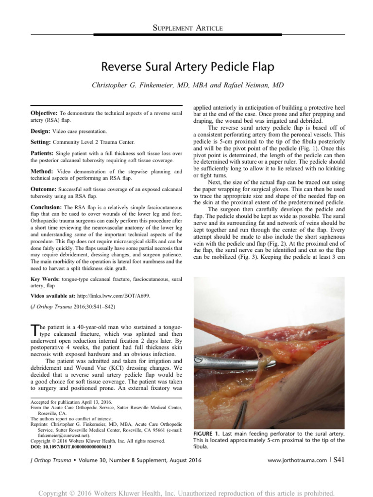 Reverse Sural Artery Pedicle Flap.20 | PDF | Surgery | Necrosis