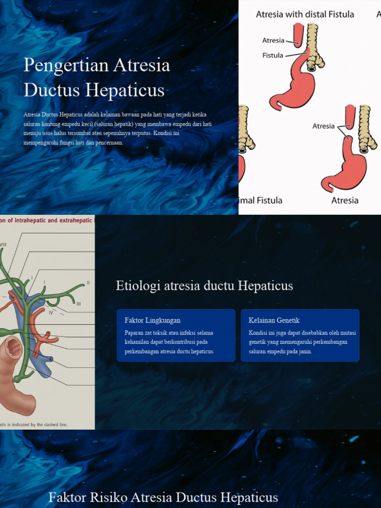 Atresia Ductus Hepaticus: Panduan Medis | PDF