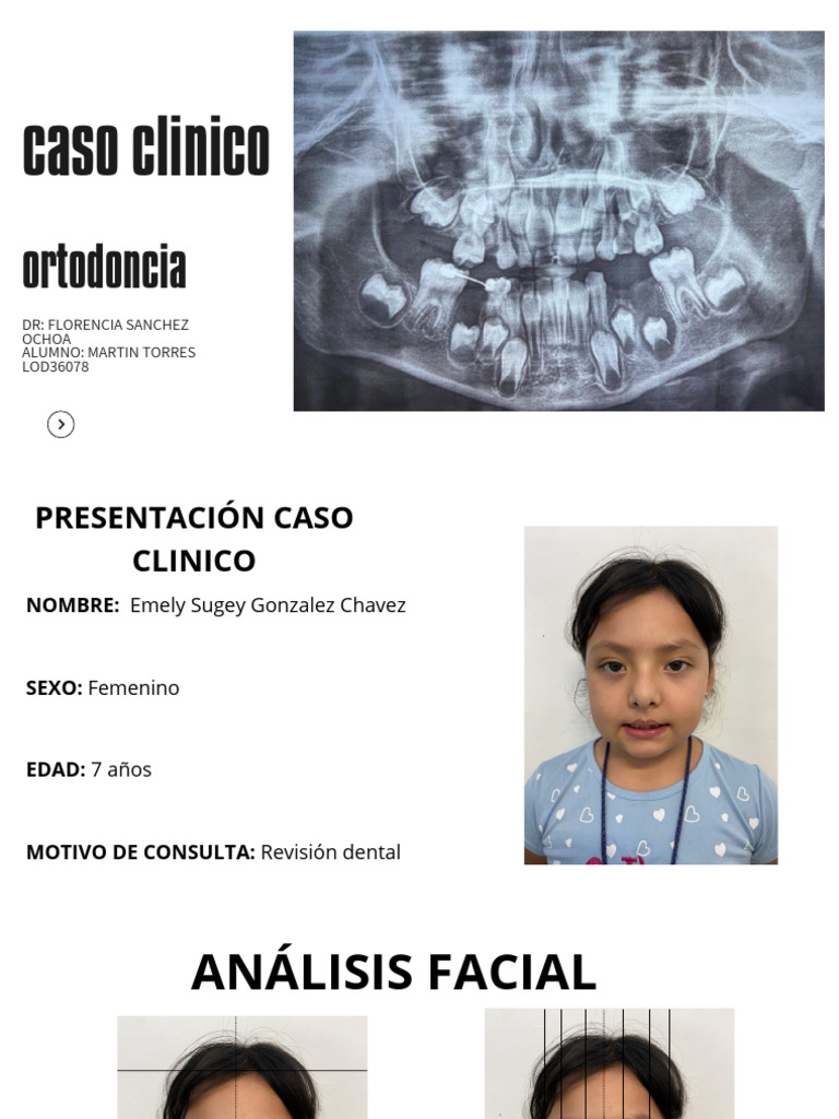 Caso Clinico Ortodoncia | PDF | Ortodoncia | Odontología
