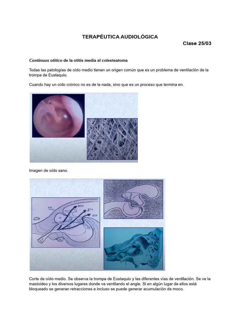 Terapéutica Audiológica | PDF | Especialidades Medicas | Sistema Auditorio