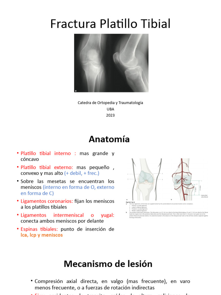 Fractura de Platillo Tibial: Guía Clínica | PDF | Rodilla | Sistema ...
