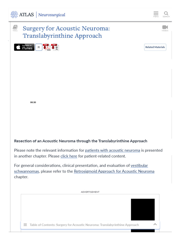 Translabyrinthine Approach - The Neurosurgical Atlas | PDF | Surgery ...