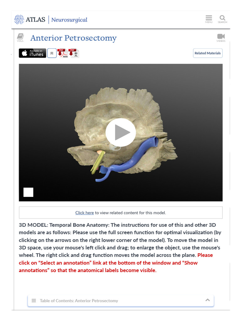 Anterior Petrosectomy Techniques | PDF | Anatomy | Human Head And Neck