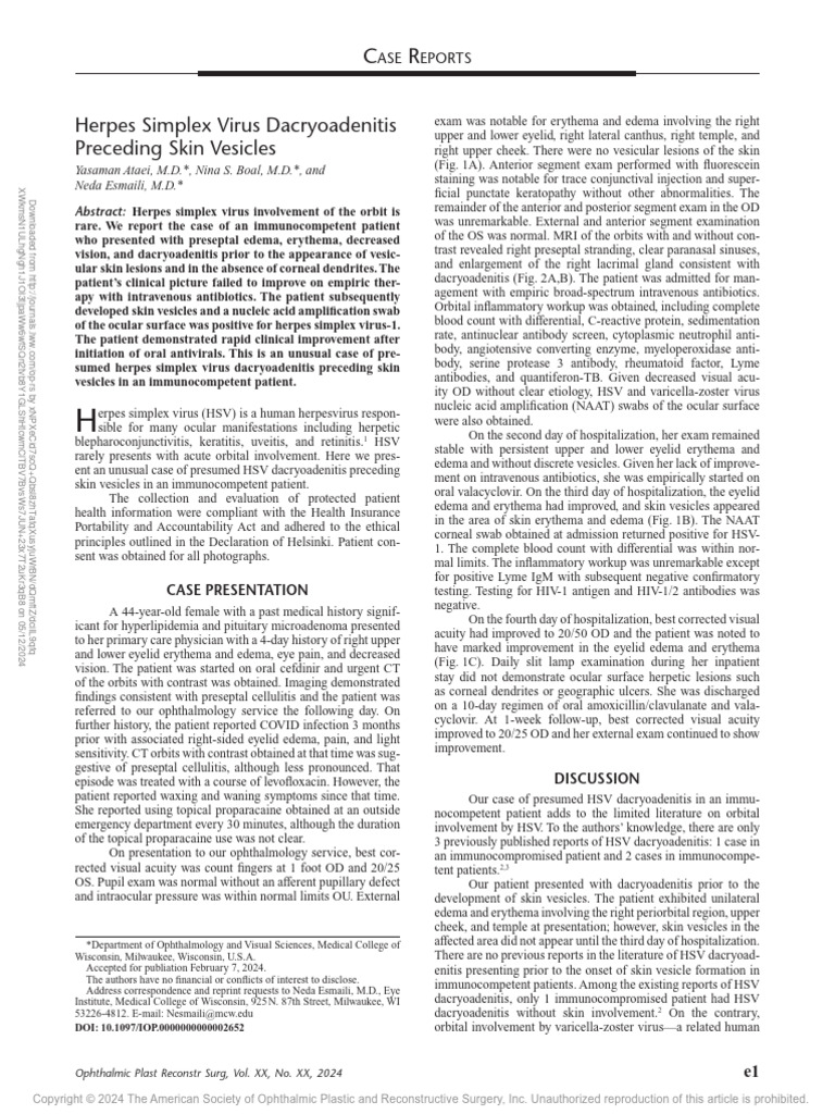 Herpes Simplex Virus Dacryoadenitis Preceding Skin.398 | PDF ...