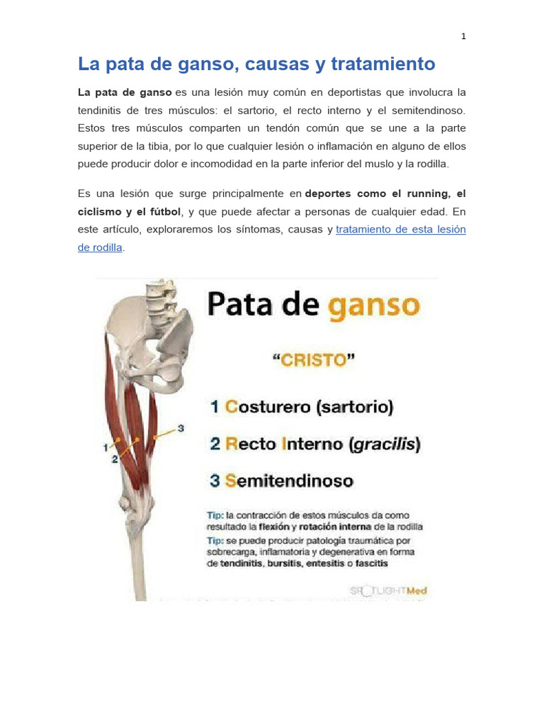 Síndrome de Pata de Ganso: Causas y Tratamiento | PDF | Rodilla | Hombro
