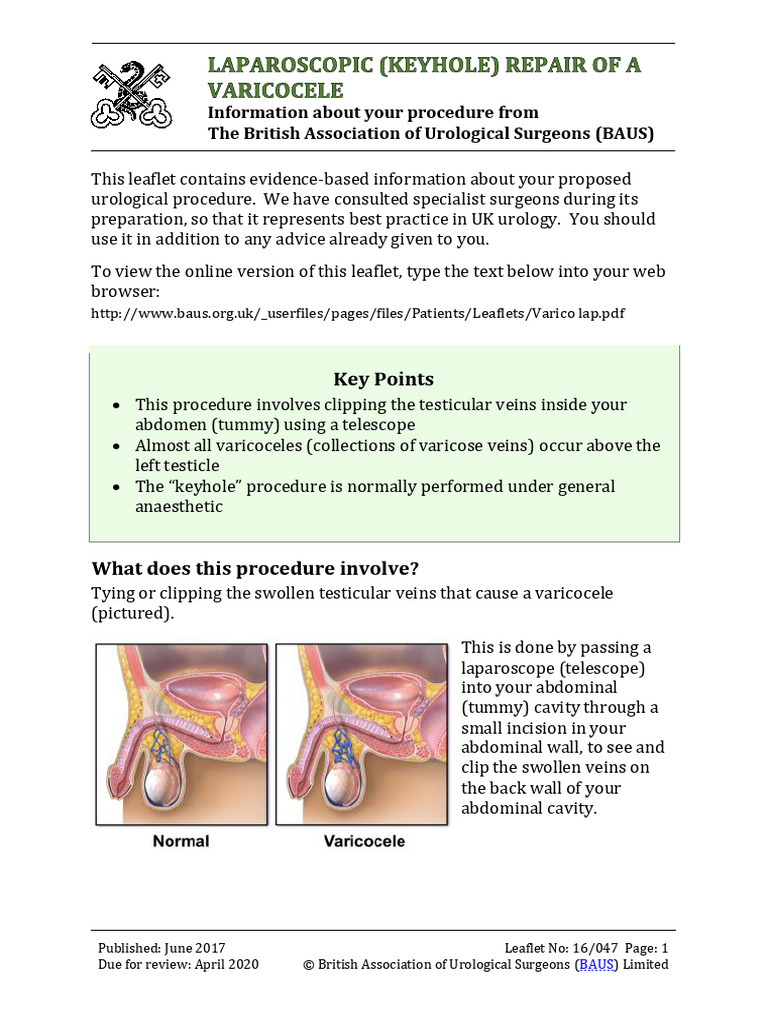 Laparoscopic Keyhole Repair of A Varicocele | PDF | Surgery | Urology