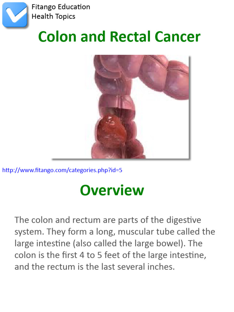Stage 1 Colon Cancer Stool Insights | PDF | Colorectal Cancer | Cancer