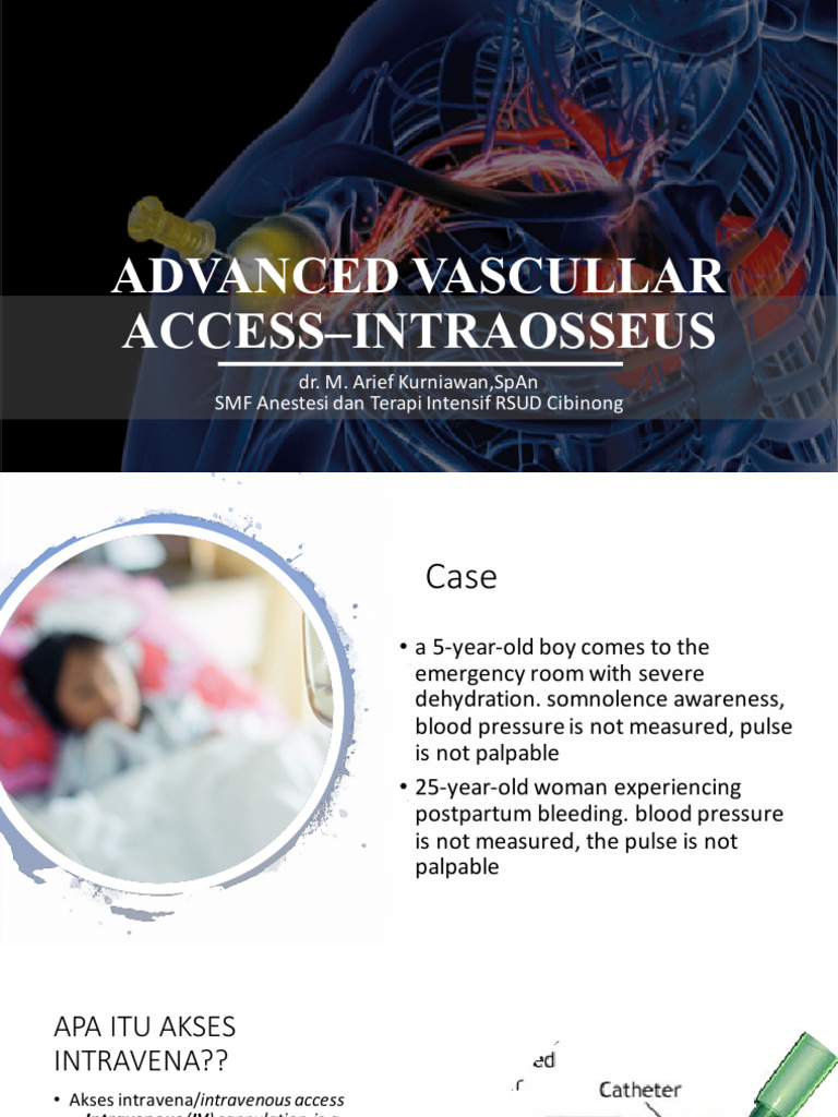 Materi Advance Vascular Access DR Arief SpAn 2 | PDF | Medical ...
