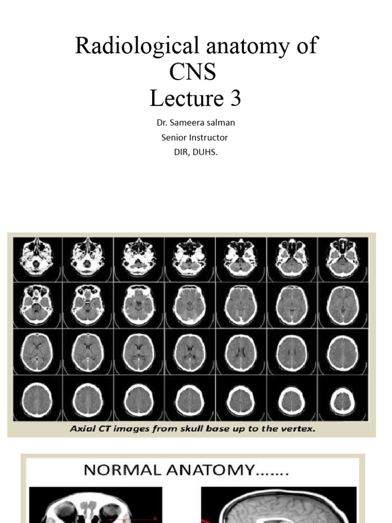 Lecture 3 Radiology Anatomy of CNS | PDF | Wellness | Science & Mathematics