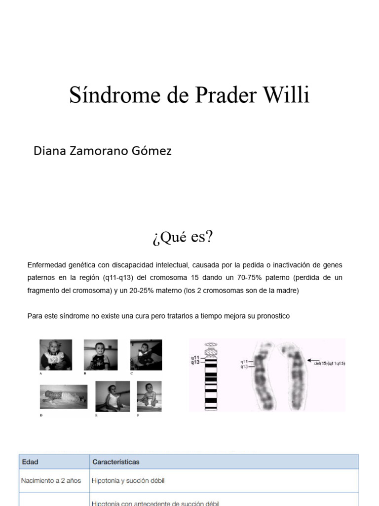 Síndrome de Prader Willi | Descargar gratis PDF | Medicina CLINICA ...