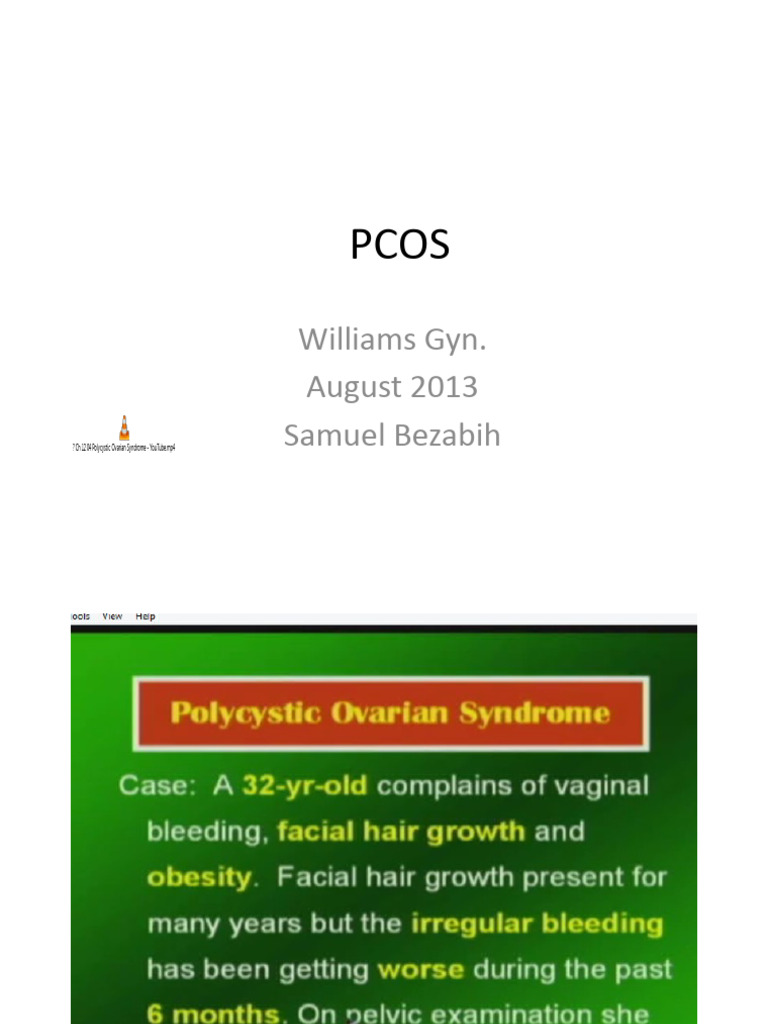 5 Pcos | PDF | Polycystic Ovary Syndrome | Luteinizing Hormone