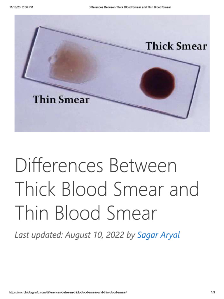 Thick and Thin Blood Smear | PDF