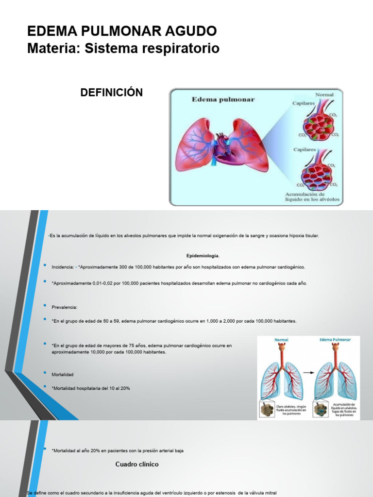 Edema Pulmonar Agudo: Guía Completa | PDF | Pulmón | Corazón