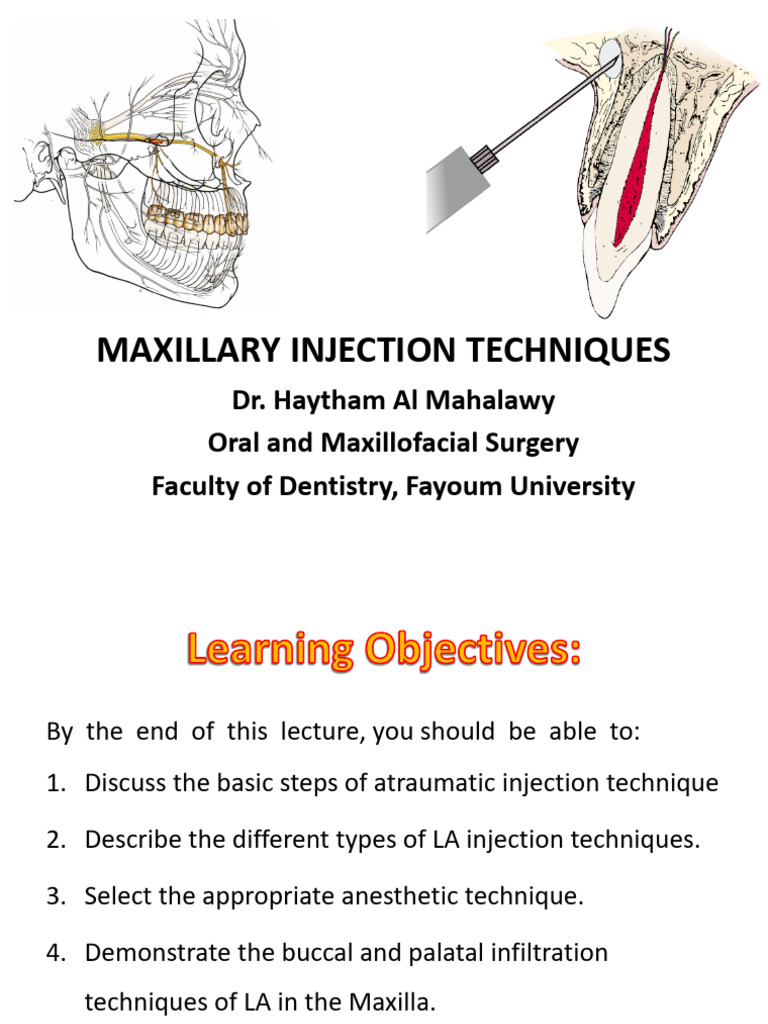 Maxillary Injection Techniques-1 | PDF | Injection (Medicine) | Anesthesia