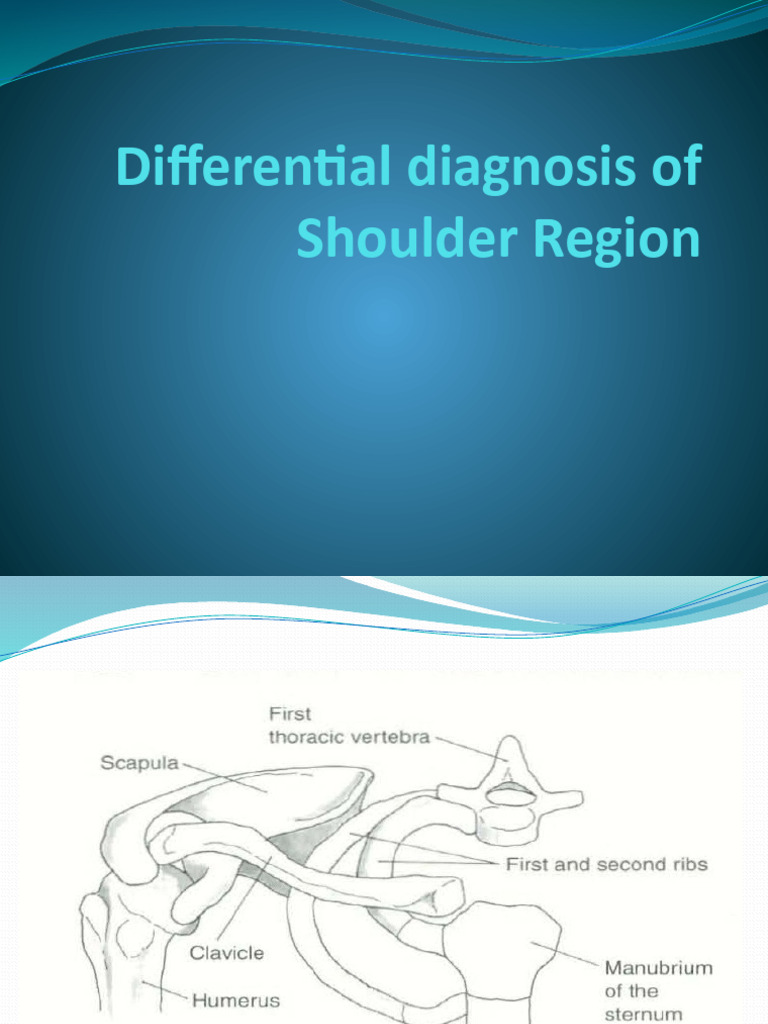 Shoulder Pain Differential Diagnosis Guide | PDF | Shoulder ...