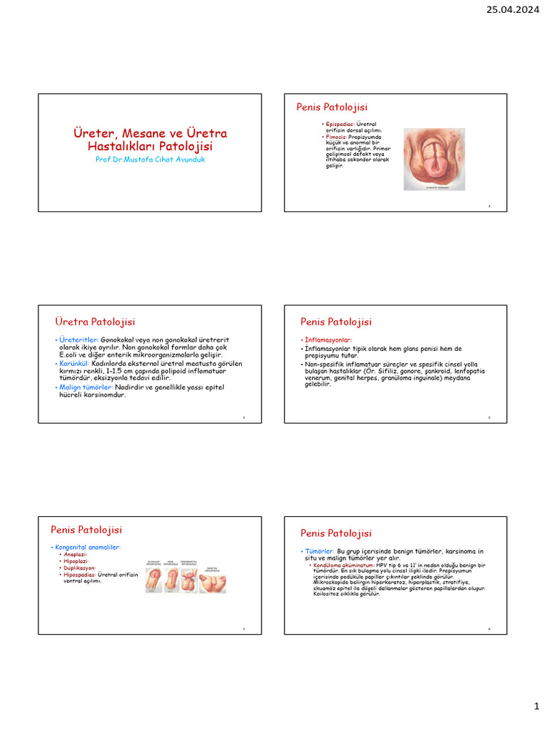 Üreter, Mesane Ve Üretra Hastalıkları Patolojisi | PDF