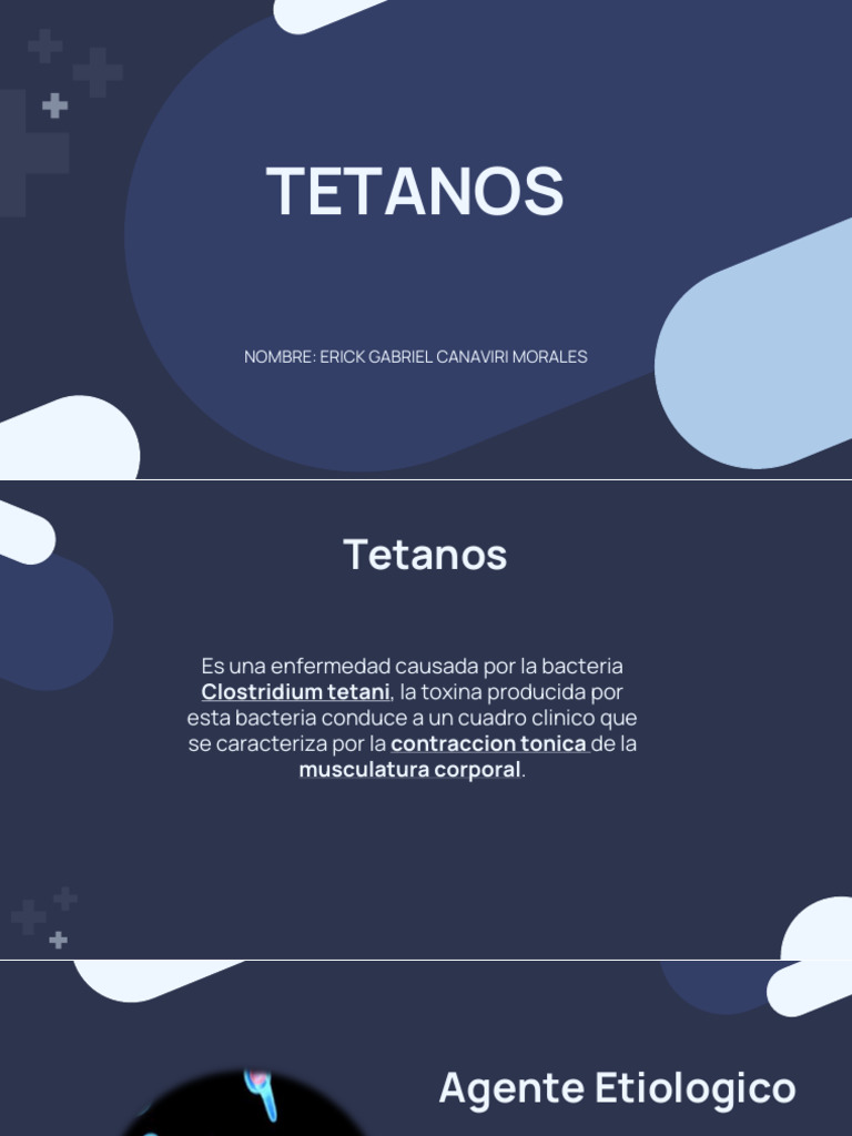 Tetanos Infecto | PDF | Especialidades Medicas | Medicina CLINICA