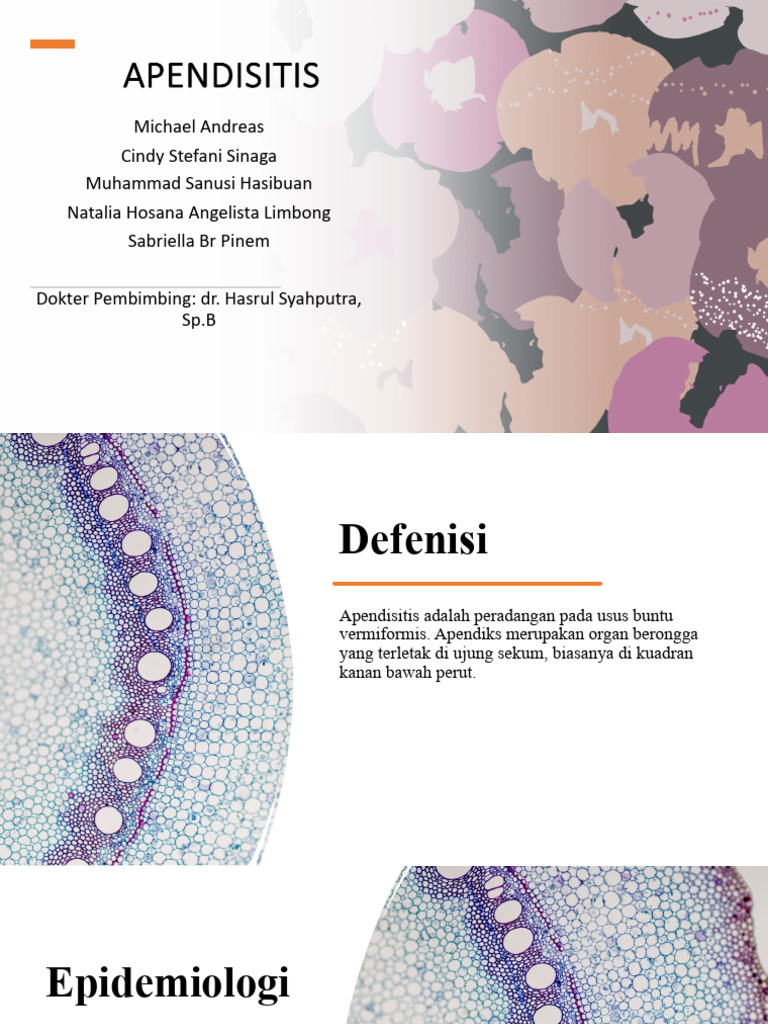 Acute Appendicitis | PDF