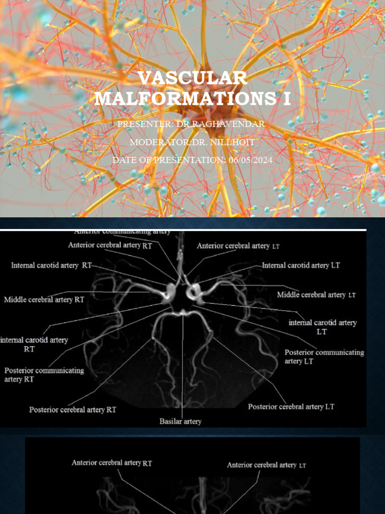 Vascular Malformations Overview and Types | PDF | Vein | Cardiovascular ...