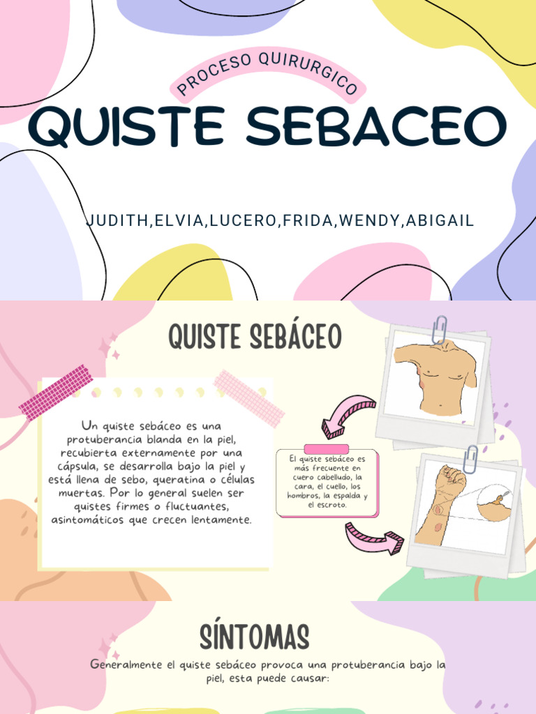 Quiste Sebaceo | Descargar gratis PDF | Cirugía | Piel