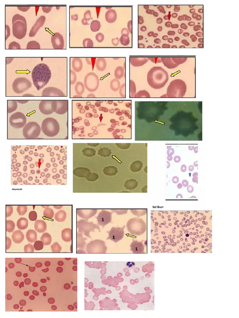 Sitdar 1 (Kelainan Erit) - 1 | PDF