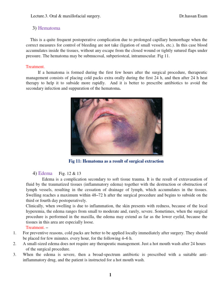 Oral Surgery Lec. 9 | PDF | Medical Specialties | Clinical Medicine
