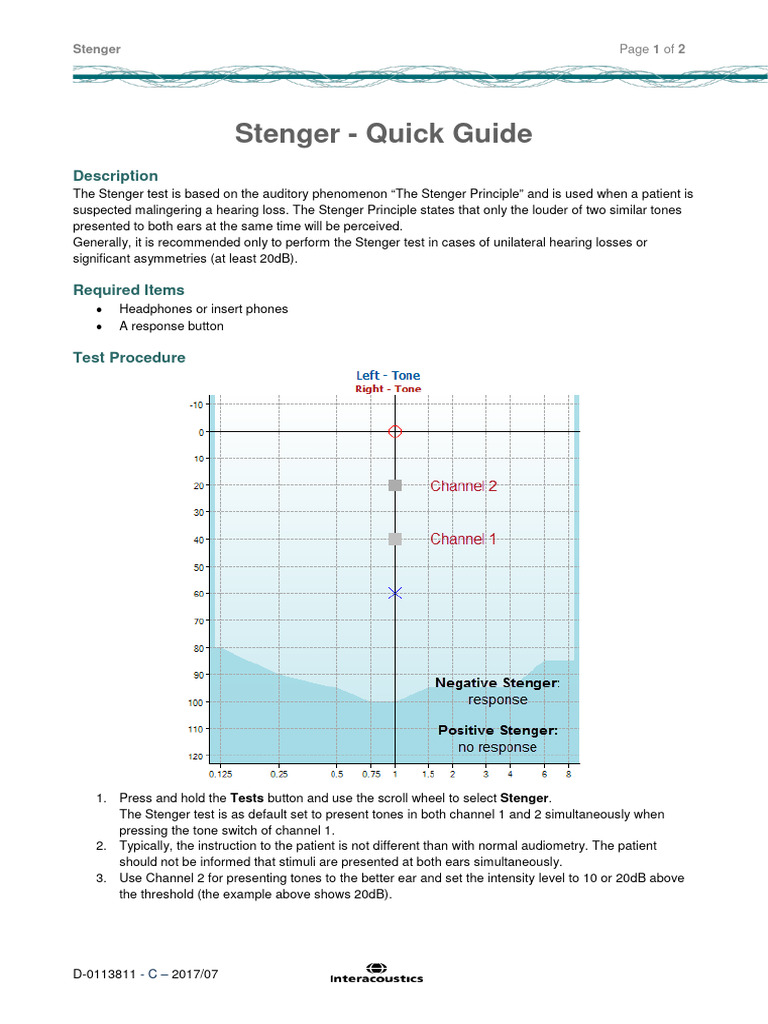Stenger | Download Free PDF | Hearing | Hearing Loss