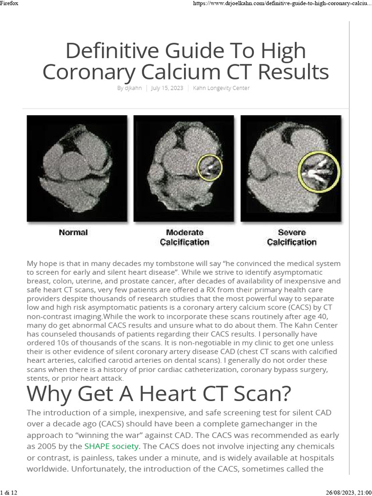 Definitive Guide To High Coronary Calcium CT Results - Dr. Joel Kahn ...