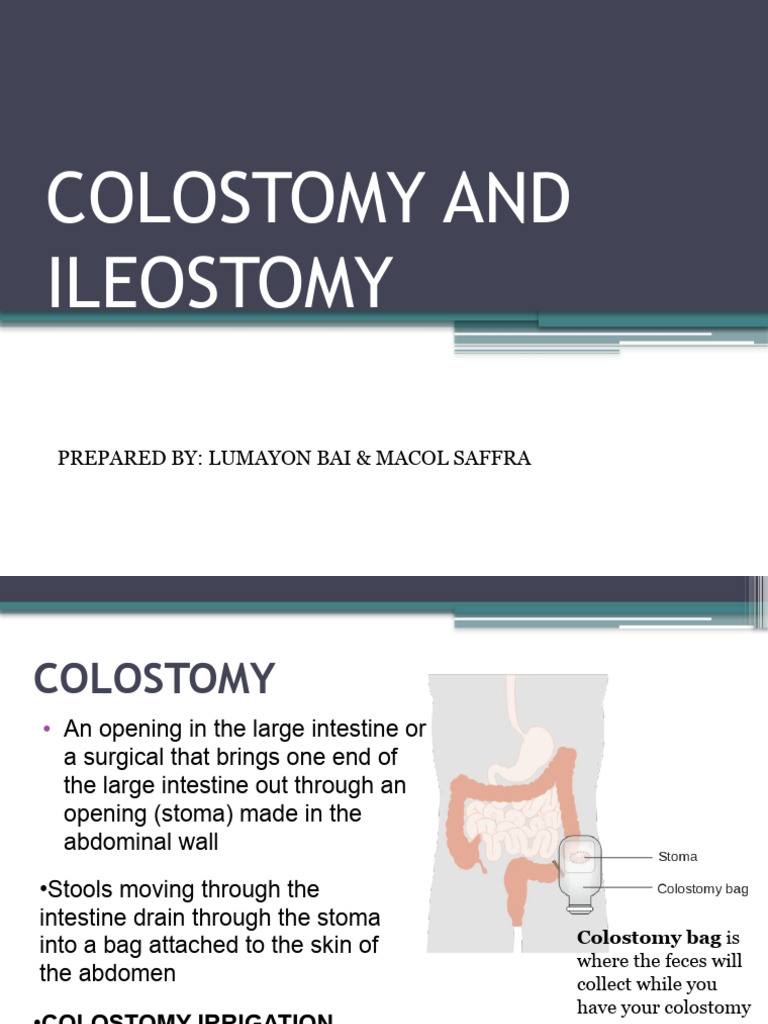 Colostomy and Ileostomy | PDF | Large Intestine | Gastrointestinal Tract